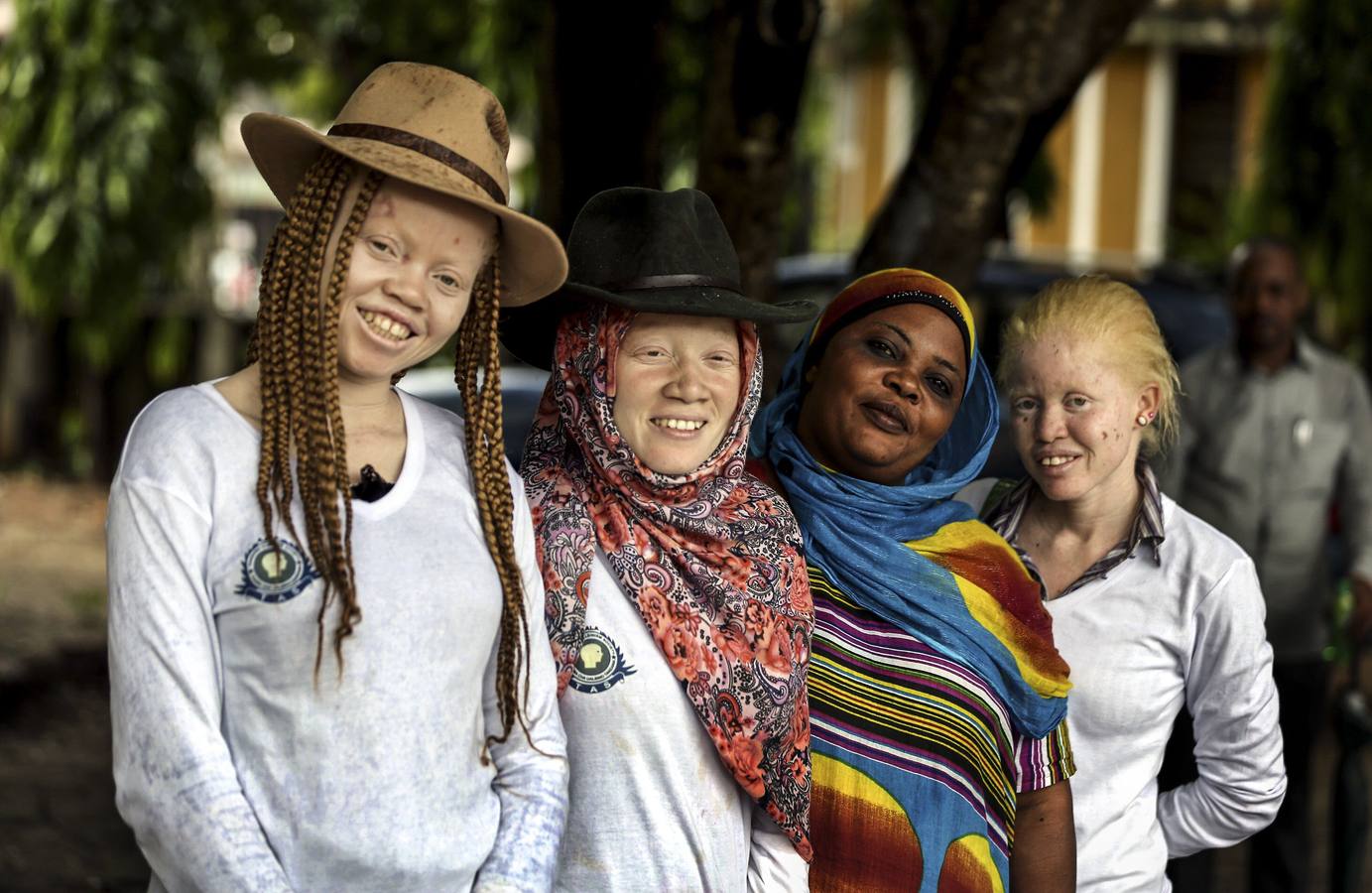 El drama de los albinos de Tanzania - elnortedecastilla.es